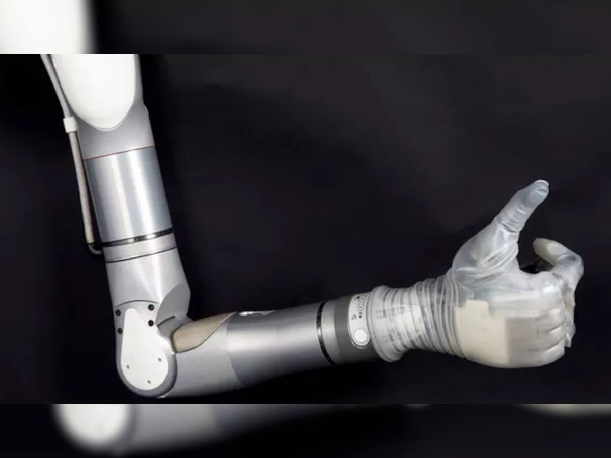 Coming very soon! Luke prosthetic arm that will change lives of ...