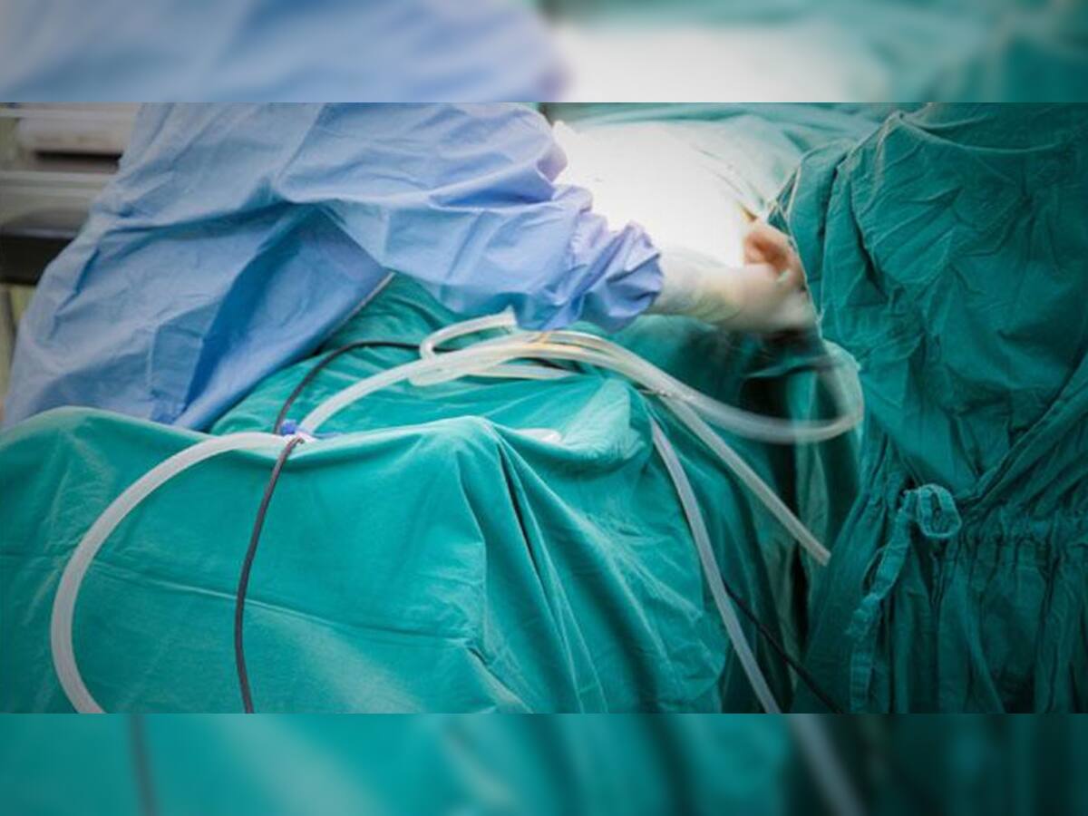 4-feet rod removed from 33-year-old mans body in 5-hour surgery