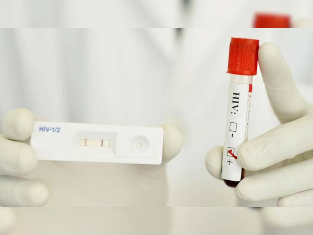 Scientists develop tool to measure success of HIV cure strategies