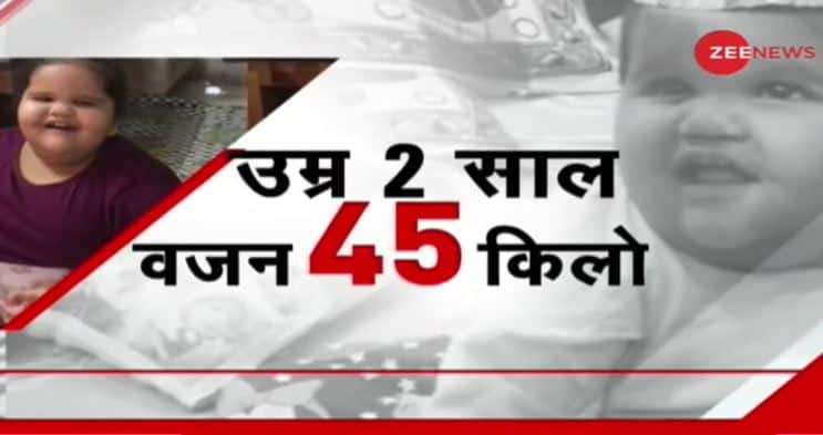 Reason for weighing 45 kg at the age of 2 years? | Zee News