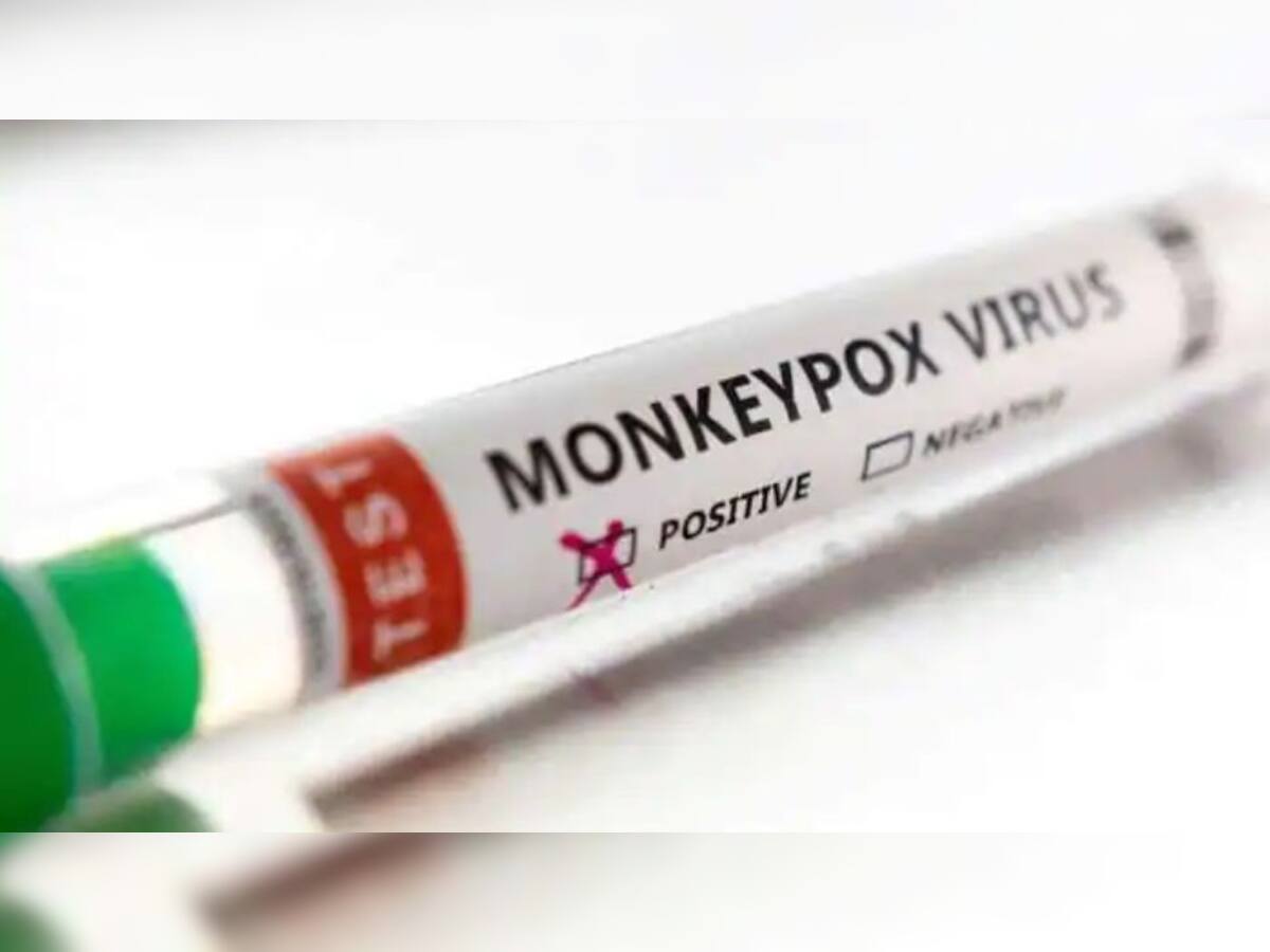 Monkeypox BIG UPDATE: Kerala reports 5th case, patient had traveled to UAE