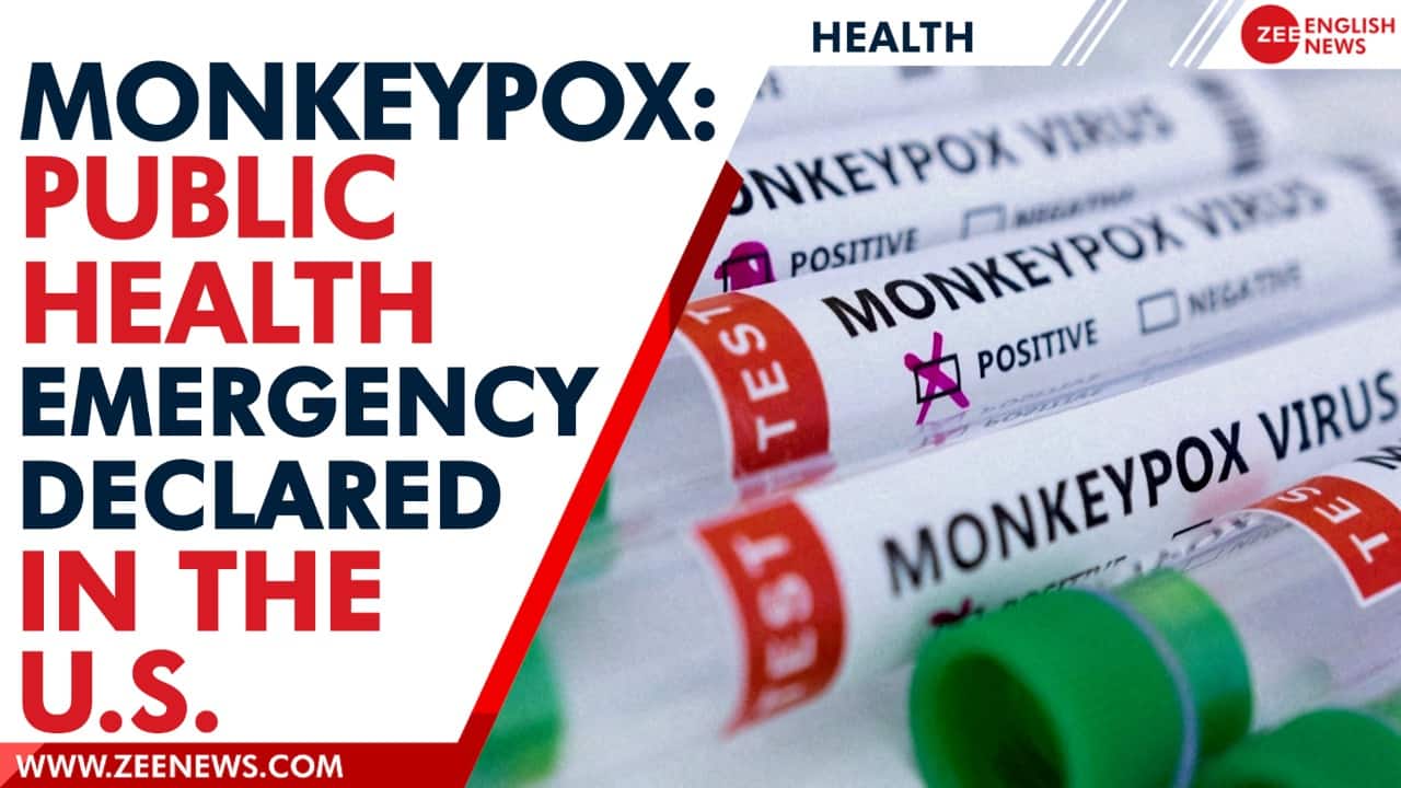 U.S. has declared Monkeypox as a public health emergency. What happens ...