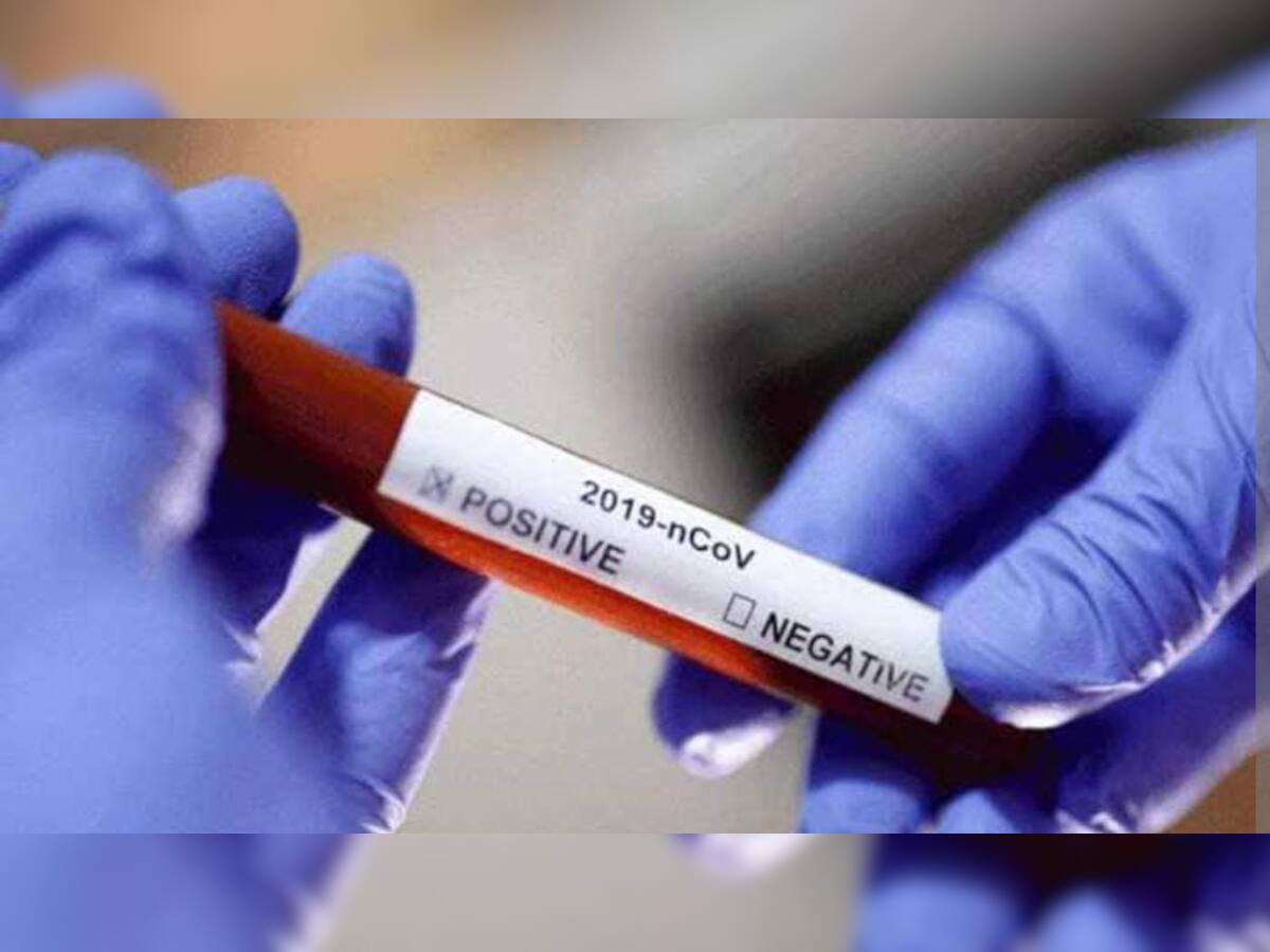 Agra Covid Update: Man who returned from China trip tests positive - BF ...