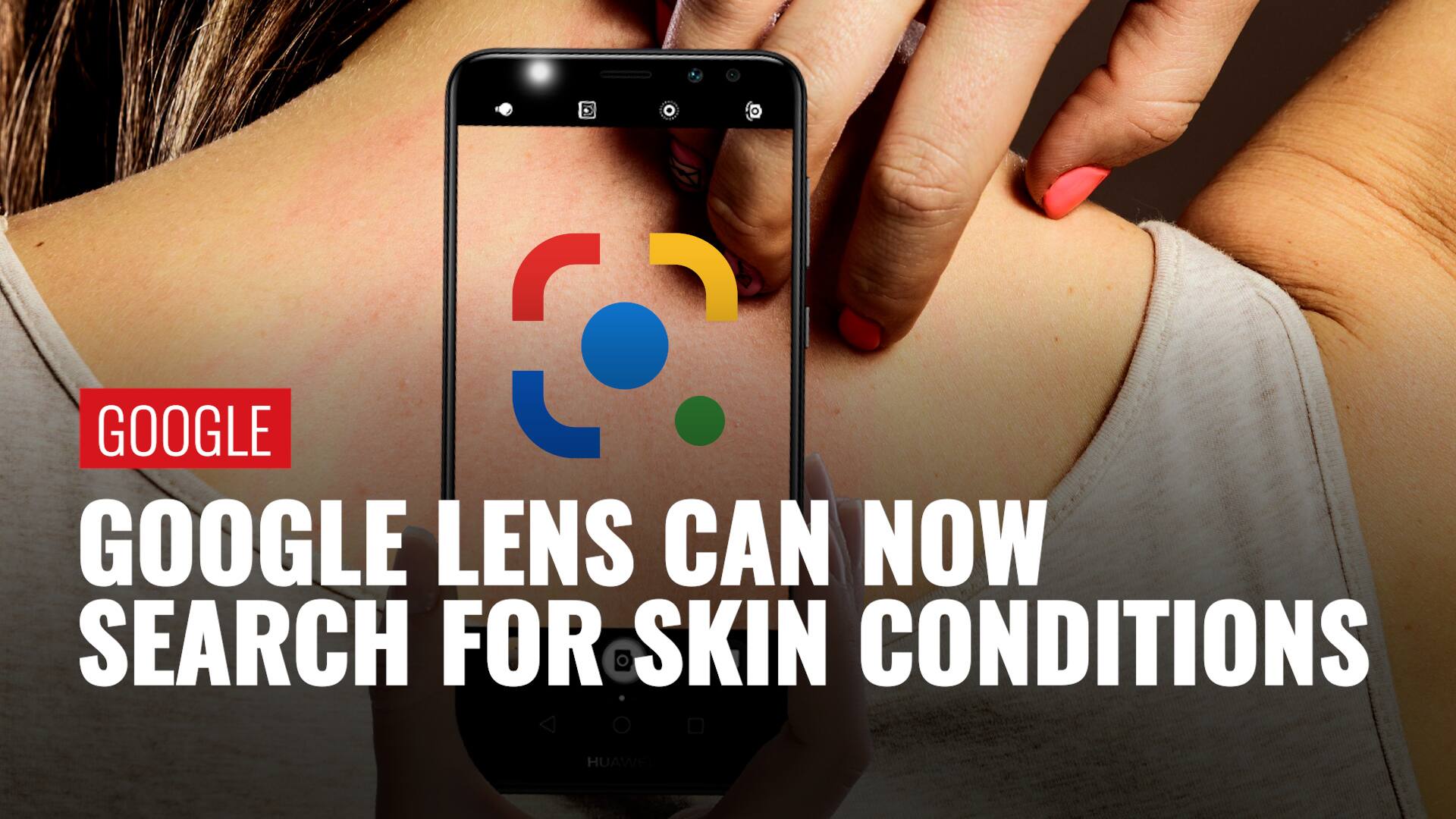 Google Lens Gets New Update, Can Identify Skin Problems With DermAssist | Zee News