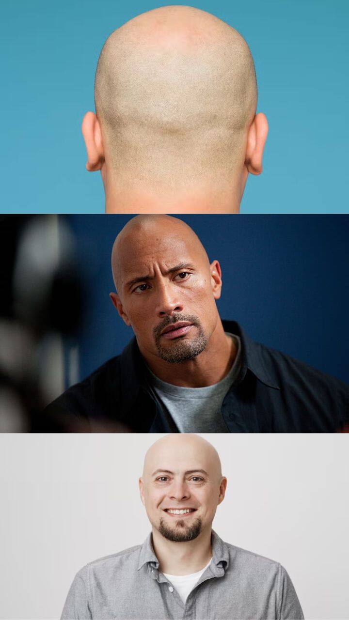 Bald Men