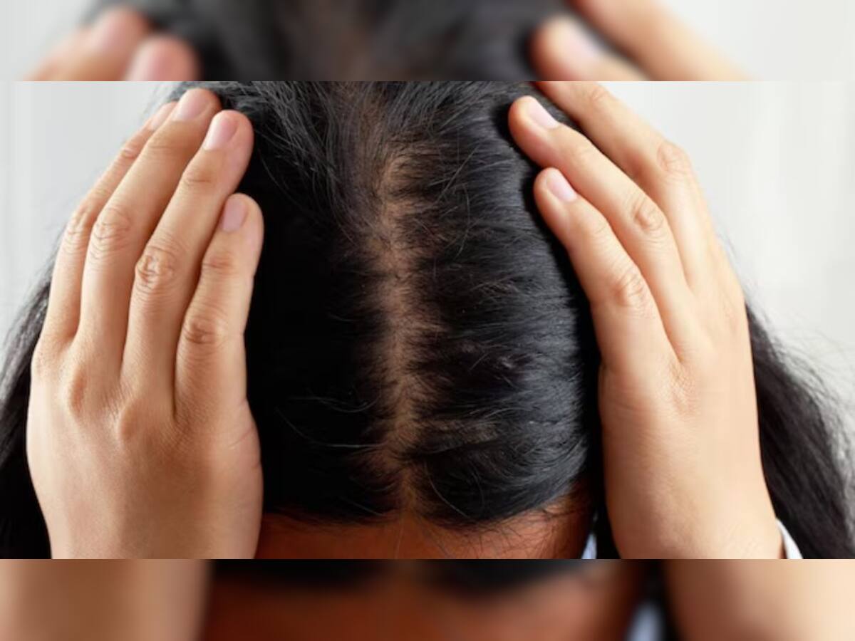 Painful Pimples on Your Scalp? Here’s Why And How To Stop Them