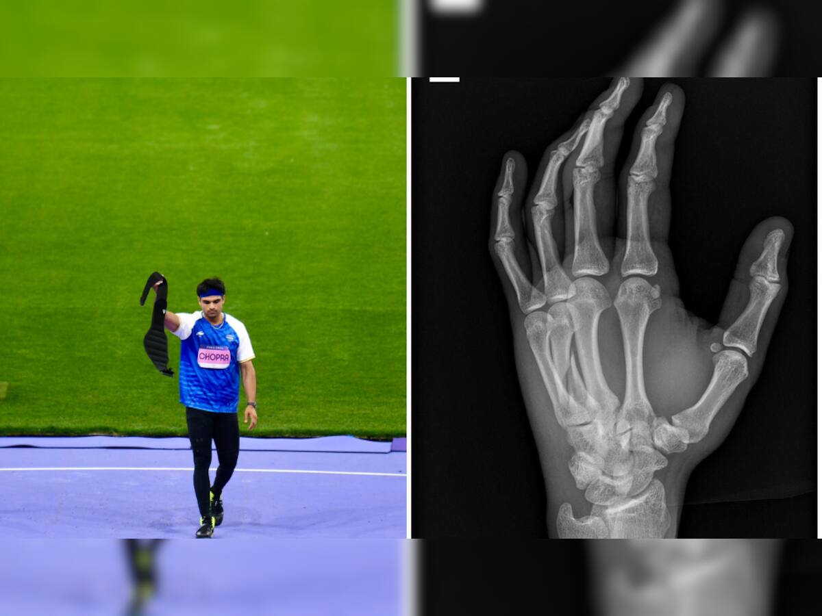 Neeraj Chopras Shocking Injury News Revealed: Javelin Star Competed ...