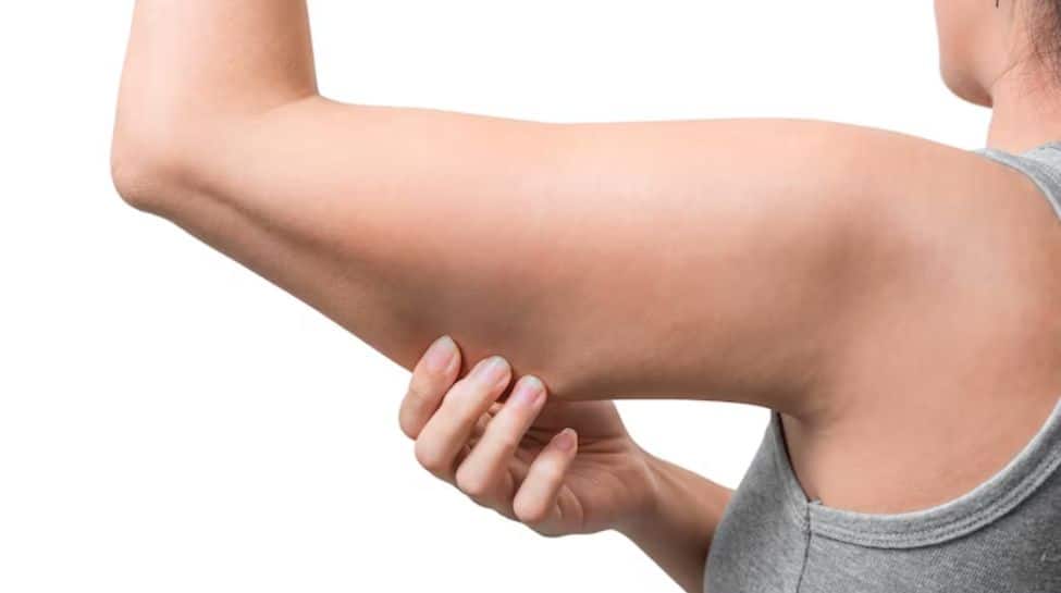 Say Goodbye To Flabby Arms: Try These 5 Simple Exercises For Quick ...