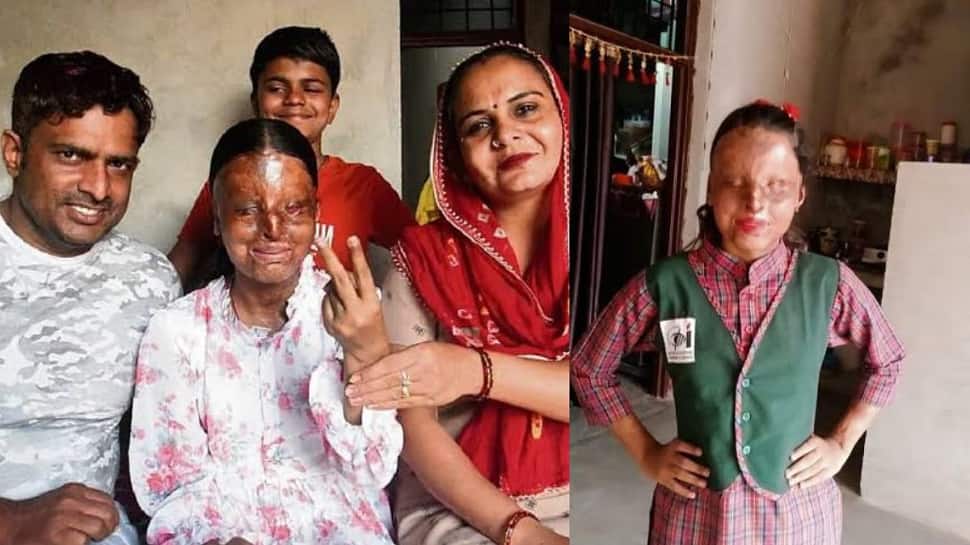 Meet Kafi: Hisar Acid Attack Survivor Who Scored 95.6% In CBSE Board ...