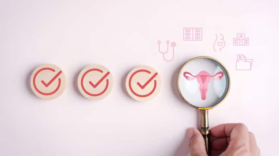 Myth vs Reality: Debunking Common Misconceptions Around PCOS And ...