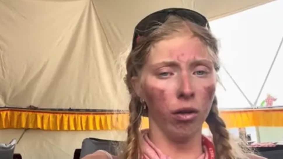 Chilling Viral Video: Australian Teen Climber Reveals Body's Toll After ...