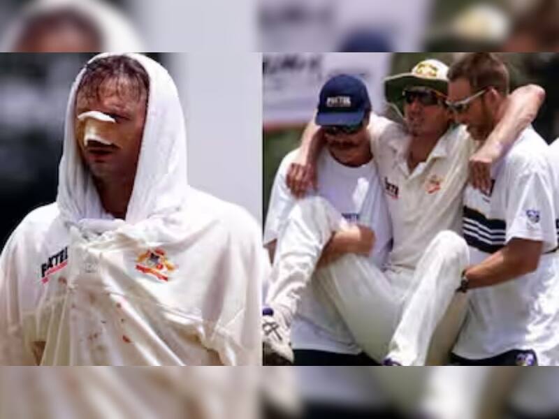 Tilak Varma To Mark Boucher: Freak Injuries That Rocked Cricket - In ...