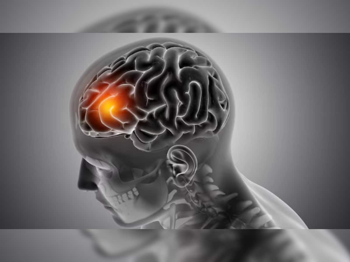 World brain tumour day: 8 warning signs of brain tumours in children ...