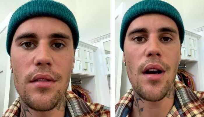 Justin Bieber's facial paralysis due to rare disorder Ramsay Hunt ...