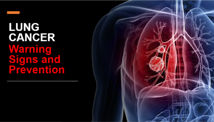 Lung Cancer: Silent Warning Signs and Preventive Measures to Take ...