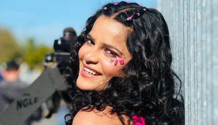 Khatron Ke Khiladi 13: Archana Gautam Injures Her Chin, Shares Photos ...