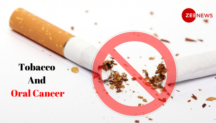How Tobacco May Lead To Mouth Cancer? Oncologist Shares Key Details Of ...