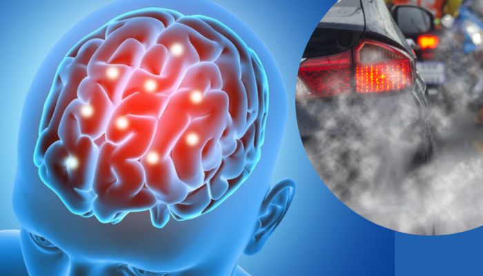 Traffic Pollution Linked To Alzheimer’s Brain Plaque Formation, Study ...
