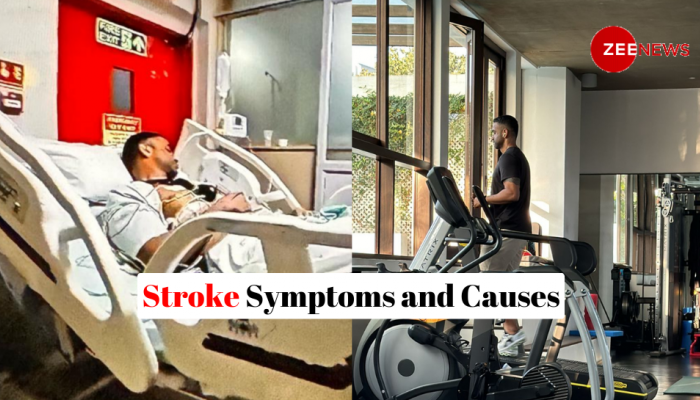 Zerodha CEO Nithin Kamath Suffered Mild Stroke: Can Stress Impact Your ...