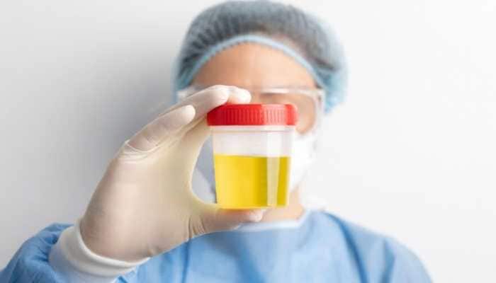 Cloudy Urine - Should You Be Worried? How To Get Right Diagnosis And ...