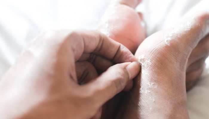 What Does Skin Pilling Mean And How to Avoid It? | Beauty/Fashion News ...