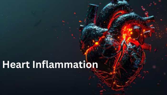 Understanding Heart Inflammation: Causes, Symptoms, And Treatment ...
